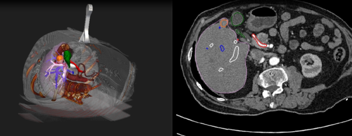 舜若科技 [SunyaTech] - 3D MINS多模态影像导航系统