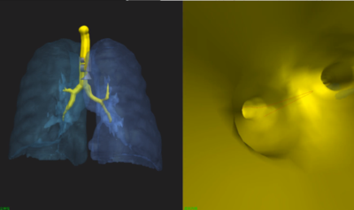 舜若科技 [SunyaTech] - 3D MINS多模态影像导航系统