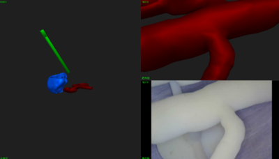 舜若科技 [SunyaTech] - 3D MINS多模态影像导航系统