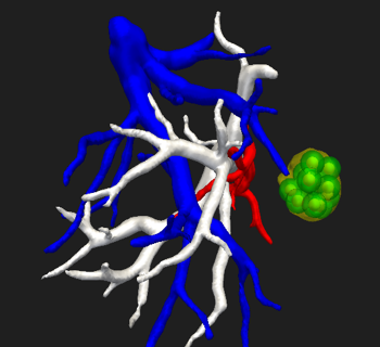 舜若科技 [SunyaTech] - 3D MINS多模态影像导航系统