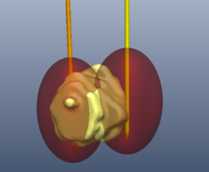 舜若科技 [SunyaTech] - 3D MINS多模态影像导航系统