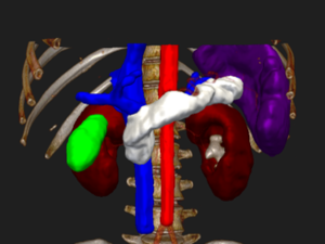 舜若科技 [SunyaTech] - 3D MINS多模态影像导航系统