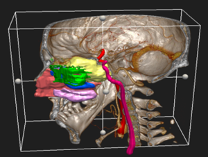 舜若科技 [SunyaTech] - 3D MINS多模态影像导航系统