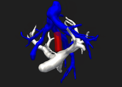 舜若科技 [SunyaTech] - 3D MINS多模态影像导航系统