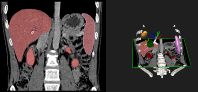舜若科技 [SunyaTech] - 3D MINS多模态影像导航系统