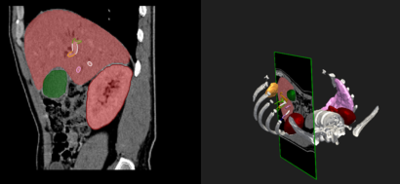 舜若科技 [SunyaTech] - 3D MINS多模态影像导航系统