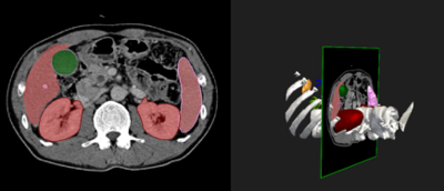舜若科技 [SunyaTech] - 3D MINS多模态影像导航系统